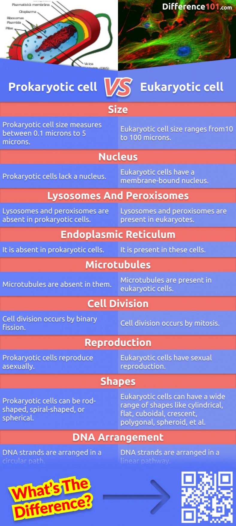 Prokaryotic vs Eukaryotic cell: 9 Differences & Examples | Difference 101