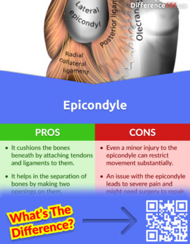 Condyle vs Epicondyle: 4 Key Differences, Examples, Pros & Cons ...