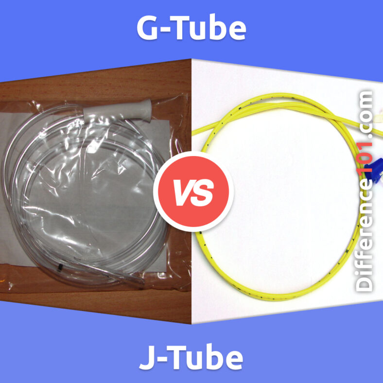 J-Tube vs. G-Tube: 5 Key Differences, Pros & Cons, Similarities | Difference 101